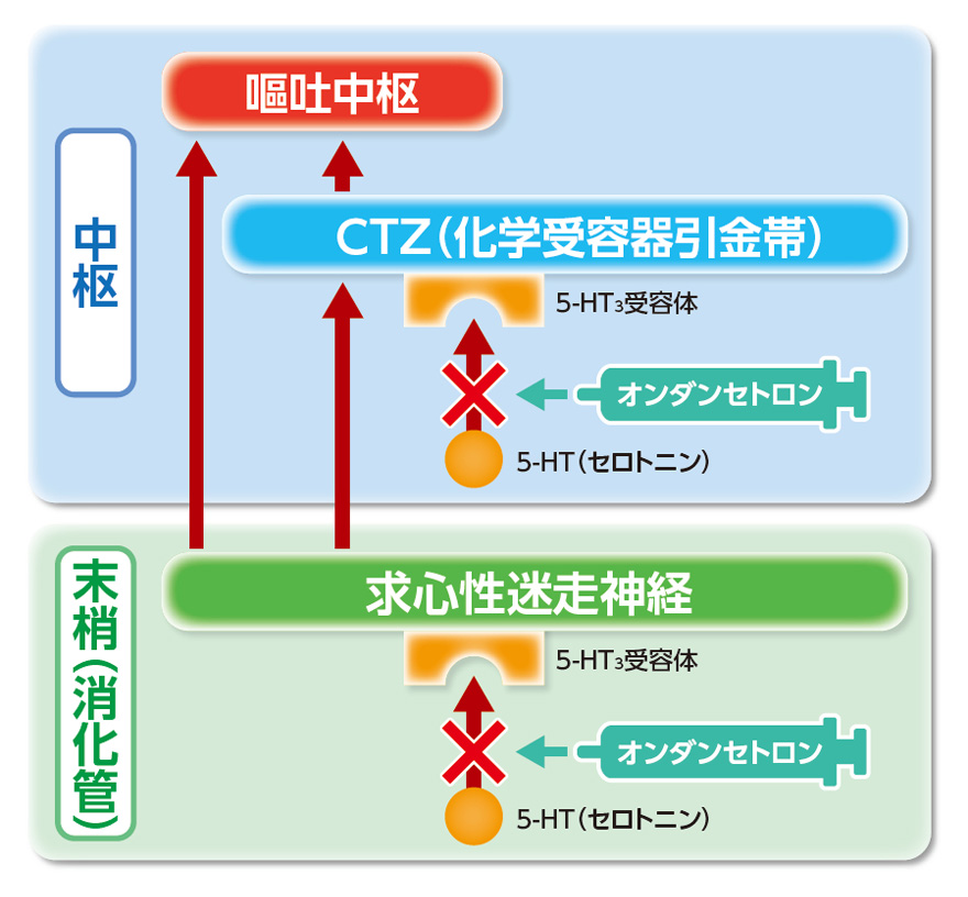 オンダンセトロン注4mgシリンジ「マルイシ」/PONV対策